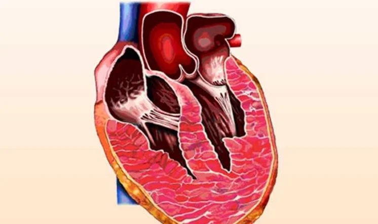 УГОЛЕМЕНО СЪРЦЕ : РИСКОВЕ, ДИАГНОЗА, ЛЕЧЕНИЕ